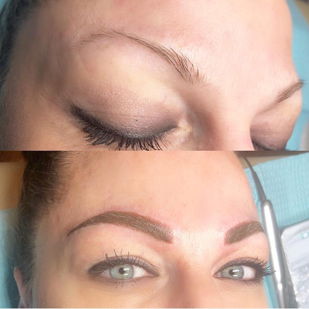 ALL YOU NEED TO KNOW ABOUT MICROBALDING 2019