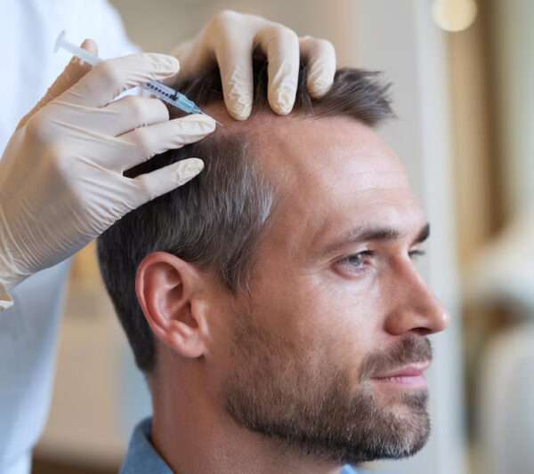 PRP for Men NYC – Hair Loss & Skin Treatment in Forest Hills
